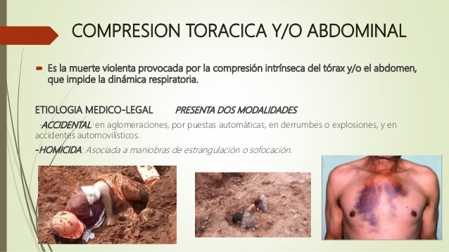 Asfixia. med. legalllllll