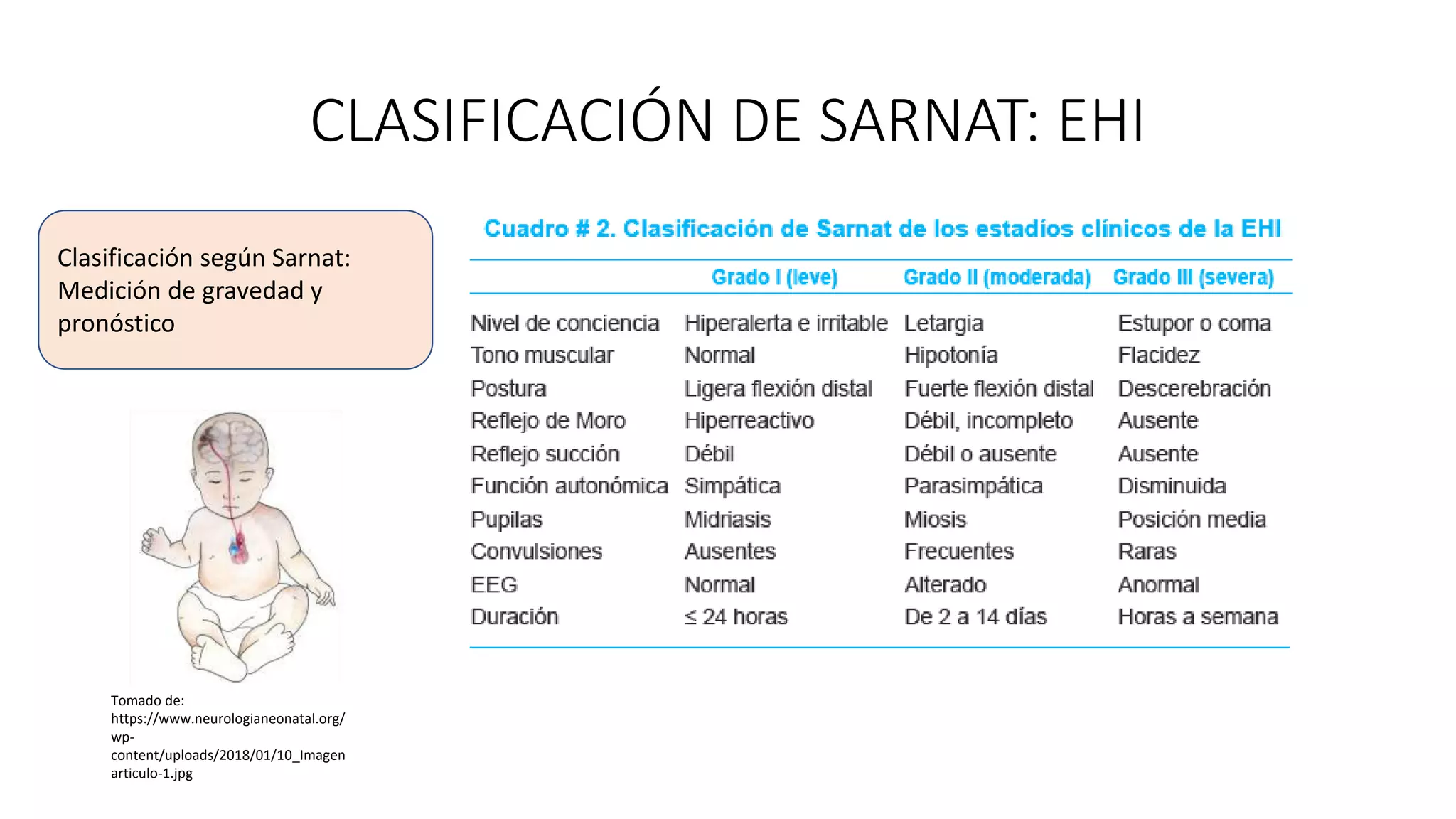 ASFIXIA PERINATAL | PPTX