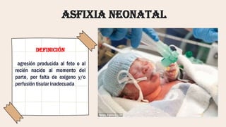 asfixia neonatal.pptxjjjjfdjjdvnfjnjdvvj | PPTX