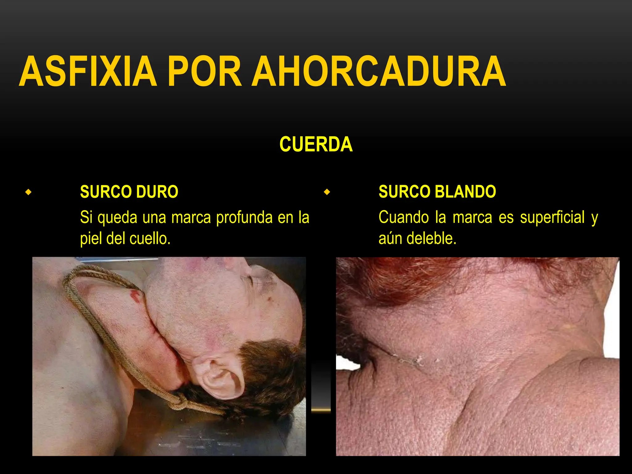 ASFIXIAS-asfixiologia-mecanicas-quimicas-patologicas.pptx