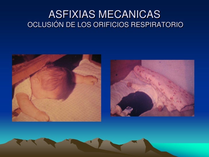 Asfixias mecanicas