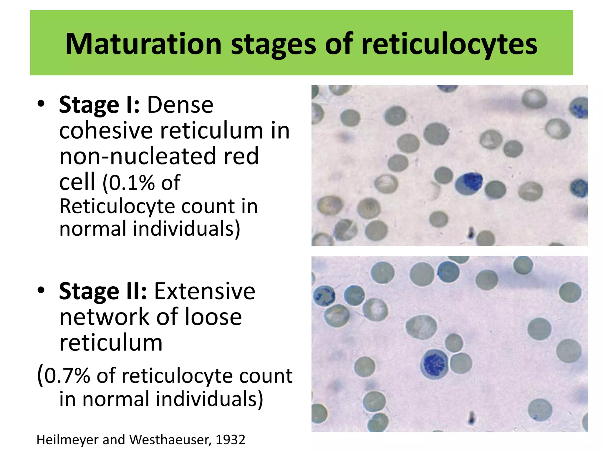 reticulocyte.pptx