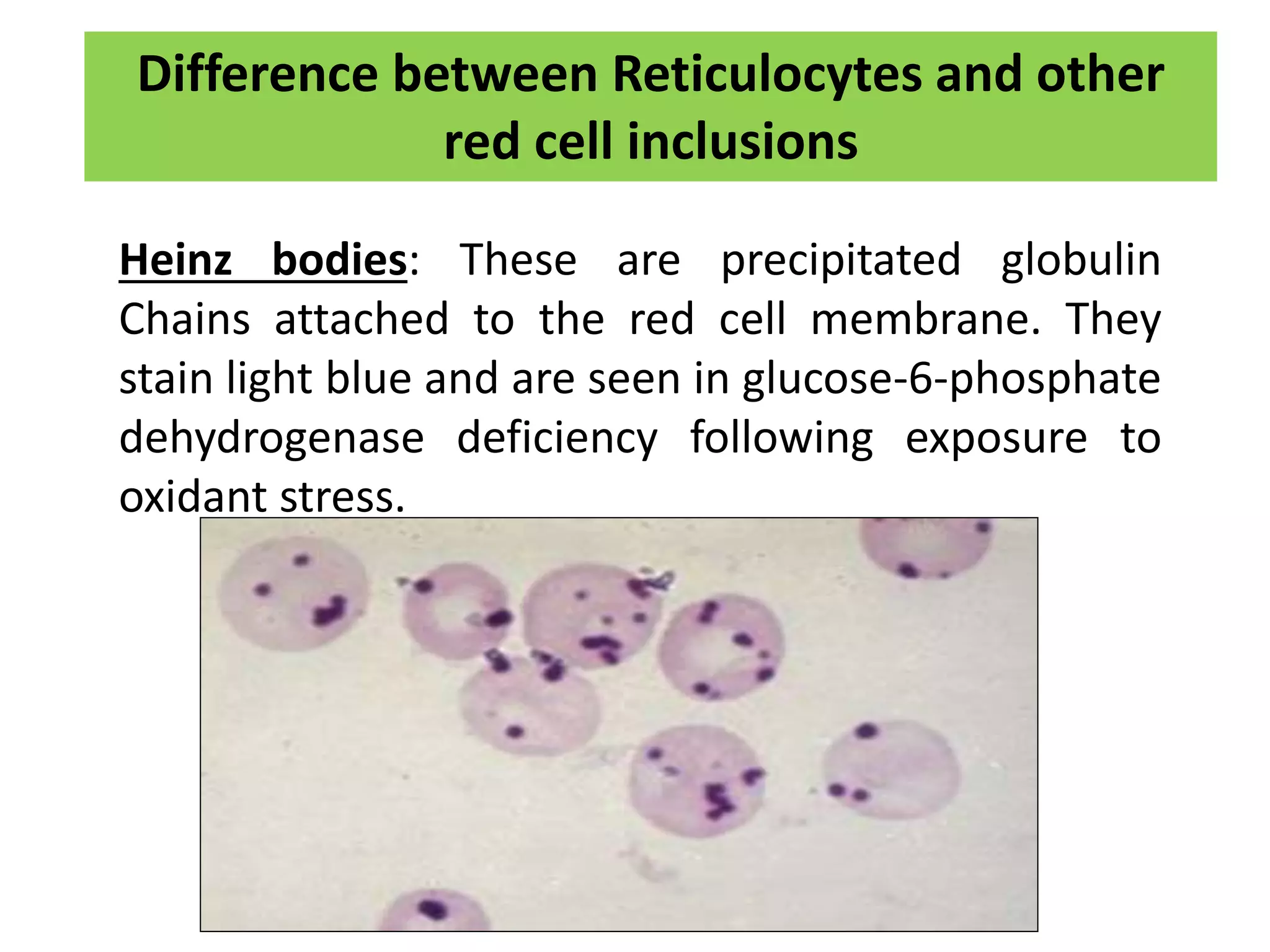 reticulocyte.pptx