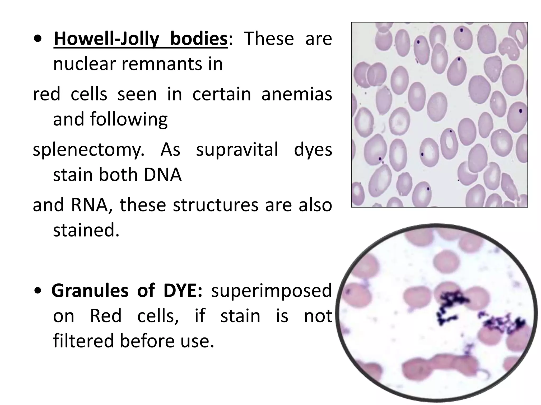 reticulocyte.pptx