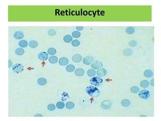 reticulocyte.pptx