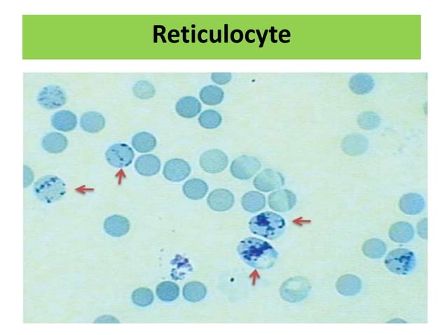 reticulocyte.pptx