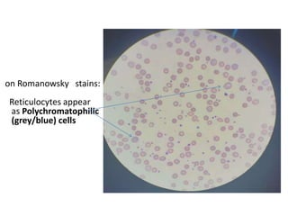 reticulocyte.pptx