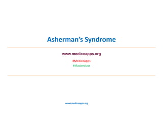 Asherman's syndrome | PDF