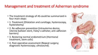 Asherman syndrome | PPTX