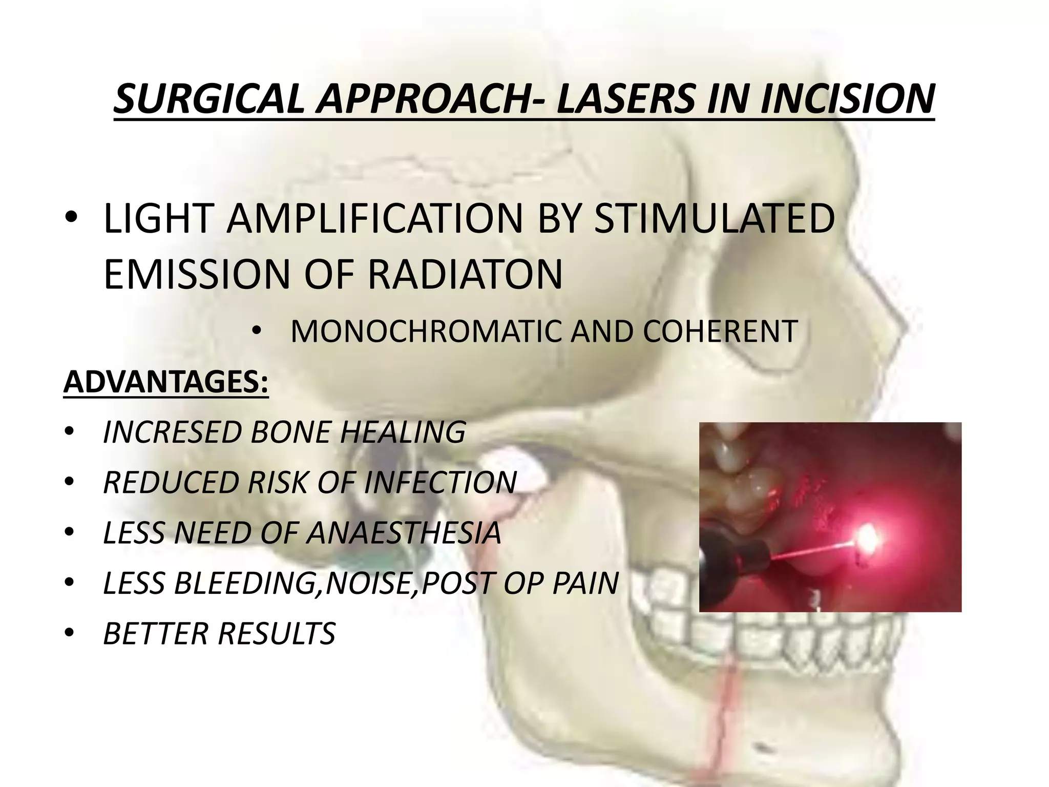 Recent advancement in management of madibular fractures | PPTX