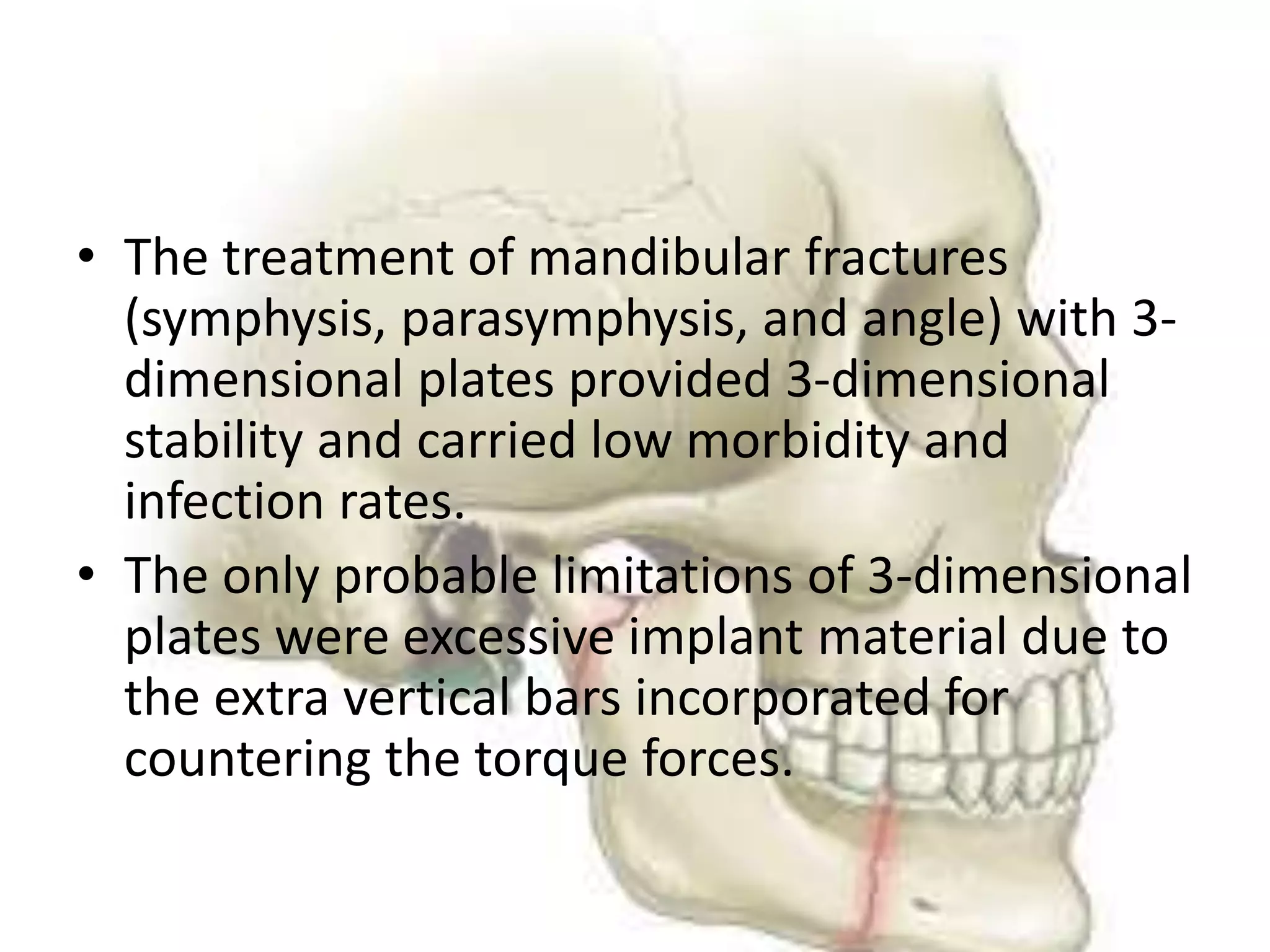 Recent advancement in management of madibular fractures | PPTX