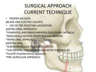 Recent advancement in management of madibular fractures | PPTX