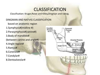 Recent advancement in management of madibular fractures | PPT