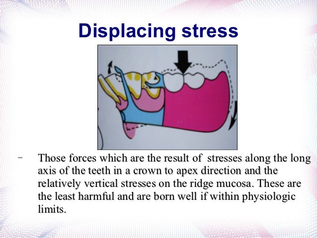 Classification of clamps, indications for use – MedMuv