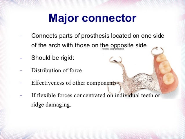 Classification of clamps, indications for use – MedMuv