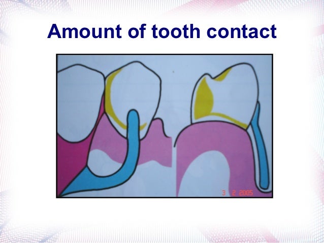 Classification of clamps, indications for use – MedMuv