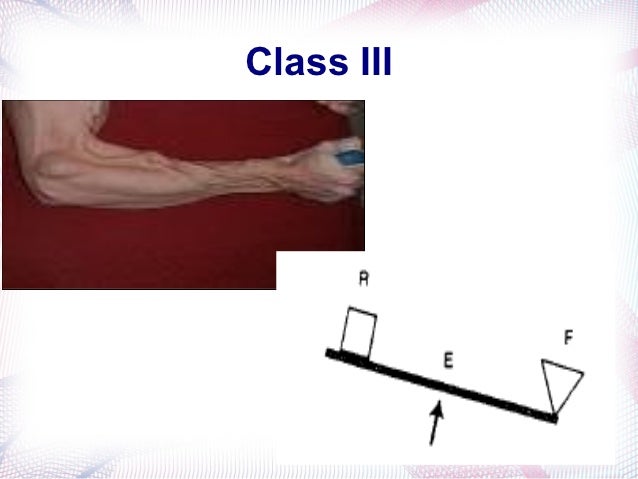 Classification of clamps, indications for use – MedMuv