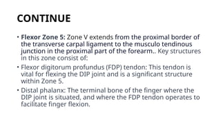 The zones of the hand flexor refer to anatomical areas of the hand ...