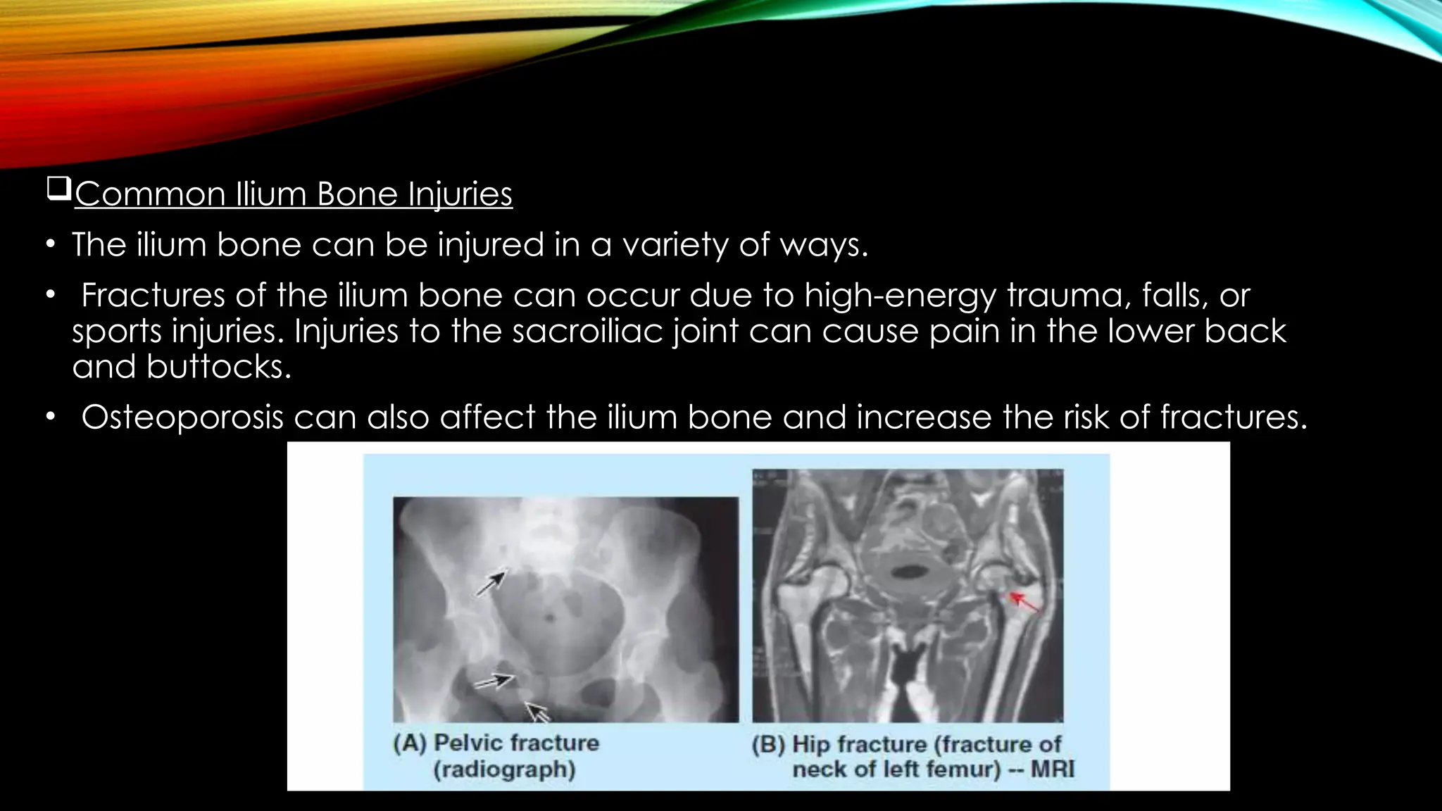 ILIUM BONE ANATOMY human body and function | PPTX