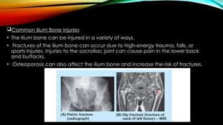 ILIUM BONE ANATOMY human body and function | PPTX