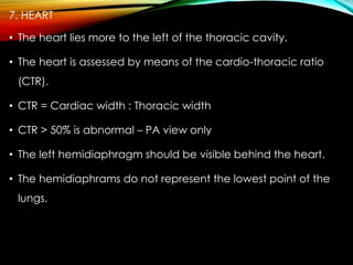 Chest X-ray & Interpretation.pptx