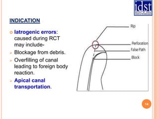Endodontic surgery Part 1 | PPTX