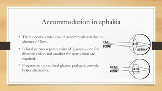 Aphakia - Ashith Tripathi | PPTX | Eye and Vision Conditions | Diseases ...