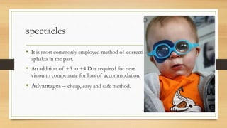 Aphakia - Ashith Tripathi | PPTX