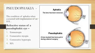 Aphakia - Ashith Tripathi | PPTX