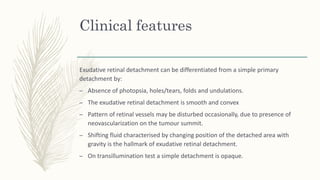 Retina - Congenital anomalies and RD by Ashith Tripathi | PPTX