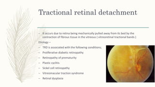 Retina - Congenital anomalies and RD by Ashith Tripathi | PPTX