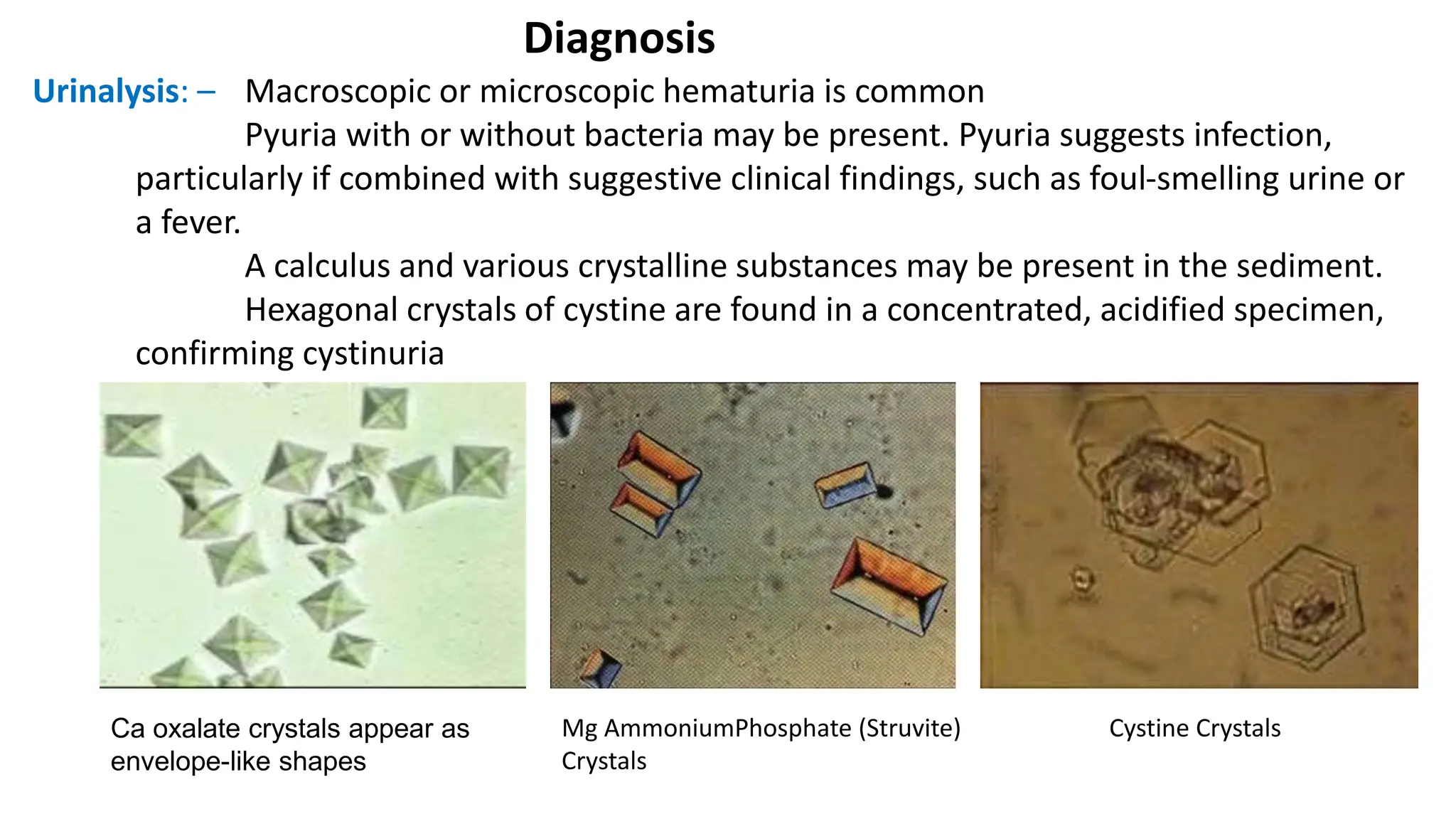 Ashmari (Urinary Calculi) Pathology & Diagnosis | PPTX