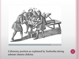 Kshara and shastra karma in the management of ashmari | PPT