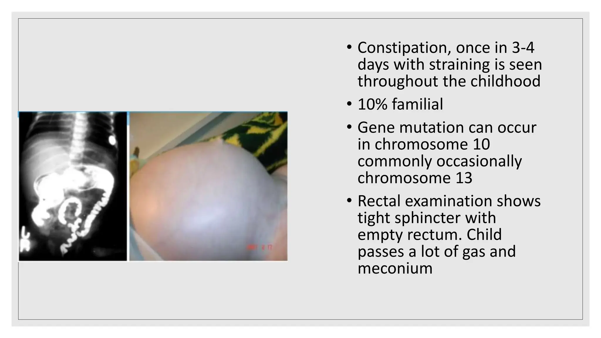 Colon Diseases, non specific ulcerative colitis | PPT