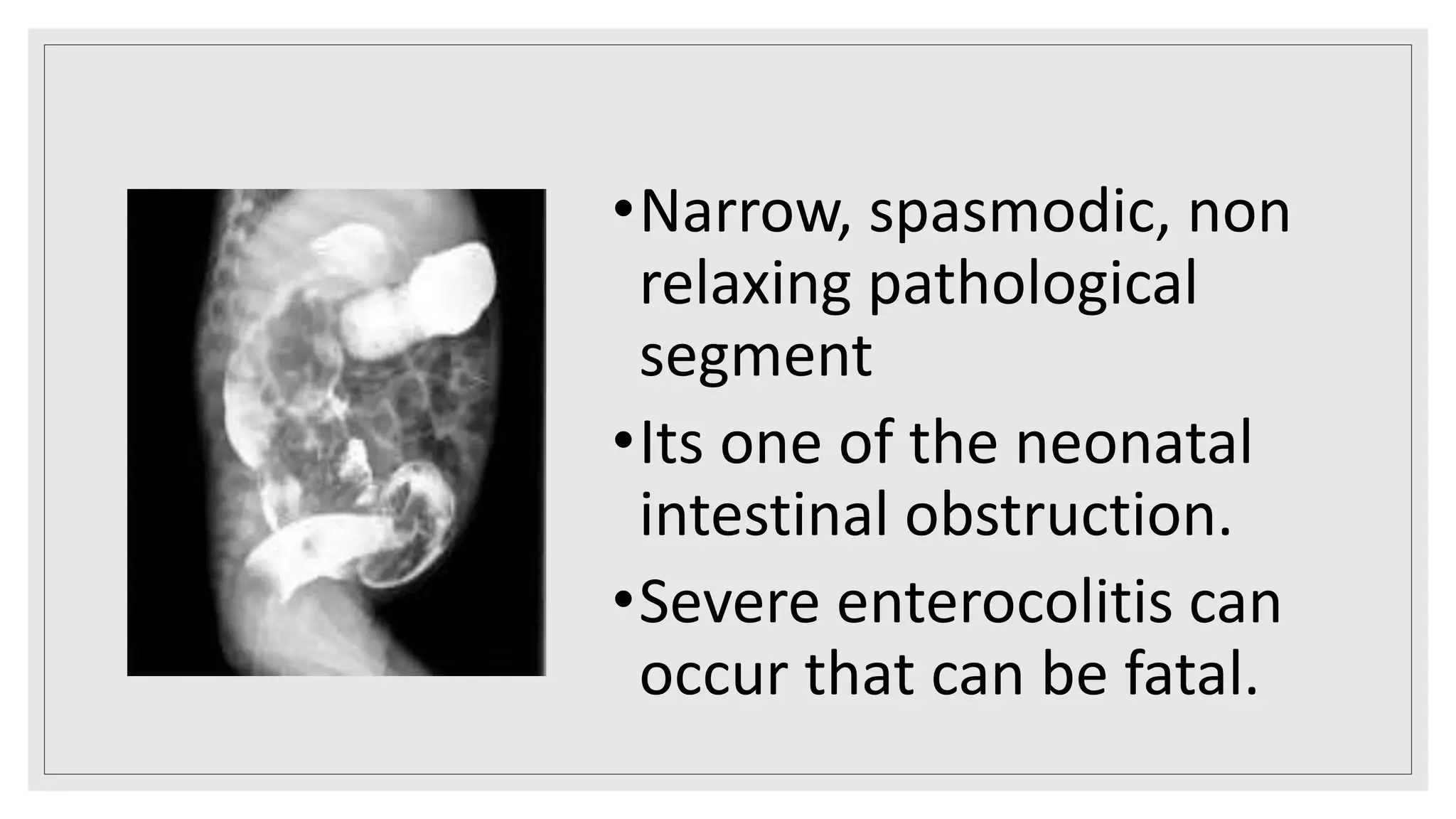 Colon Diseases, non specific ulcerative colitis | PPT