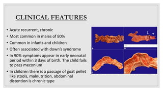 Colon Diseases, non specific ulcerative colitis | PPT