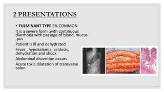 Colon Diseases, non specific ulcerative colitis | PPT