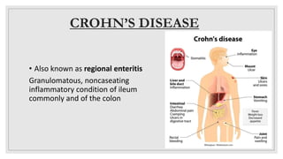 Colon Diseases, non specific ulcerative colitis | PPT