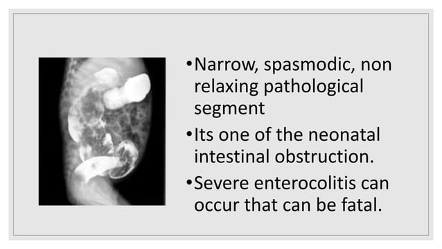 Colon Diseases, non specific ulcerative colitis | PPT