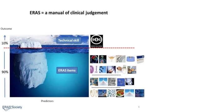 ERAS( Enhanced Recovery After Surgery) | PPTX | Physical Therapy | Wellness