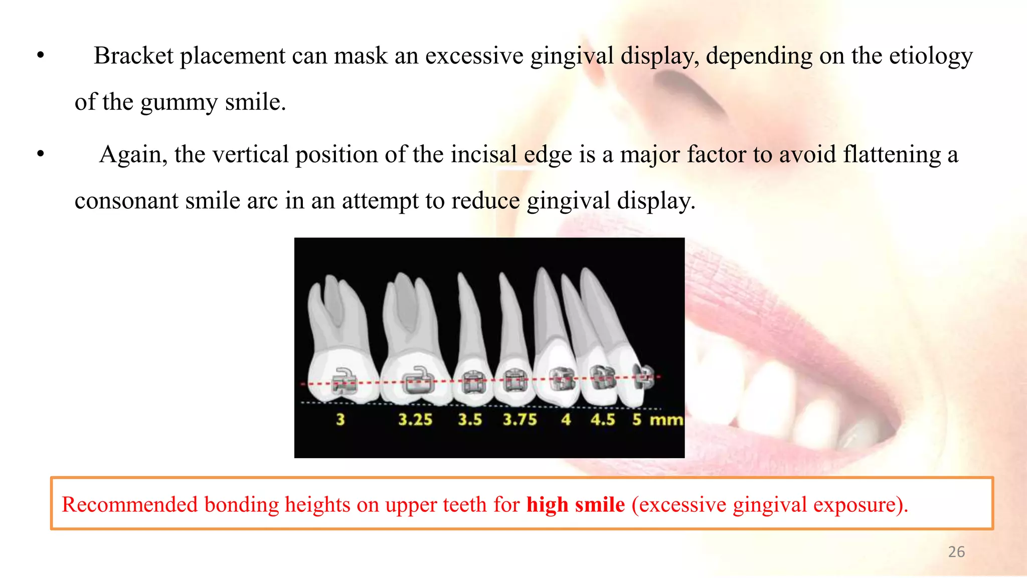 Bracket placement based on smile esthetics | PPTX