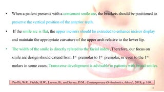 Bracket placement based on smile esthetics | PPTX