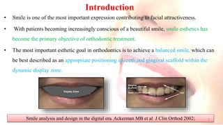 Bracket placement based on smile esthetics | PPTX