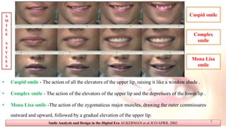 Bracket placement based on smile esthetics | PPTX