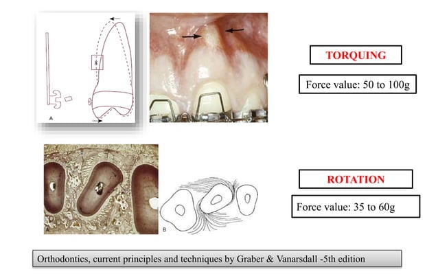 Biology of tooth movements | PPTX | Dental Health | Diseases and Conditions