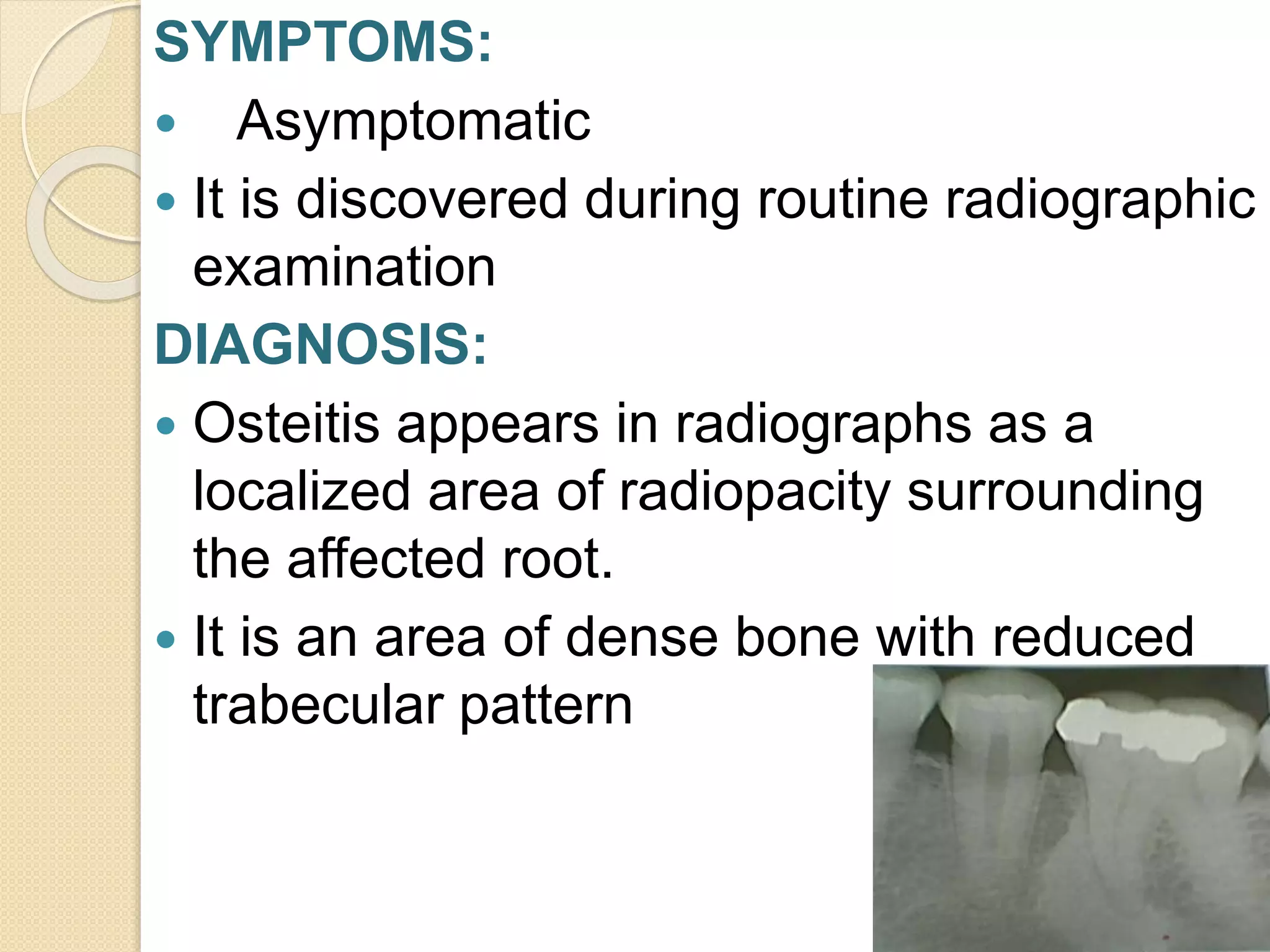 PERIAPICAL DISEASES | PPTX