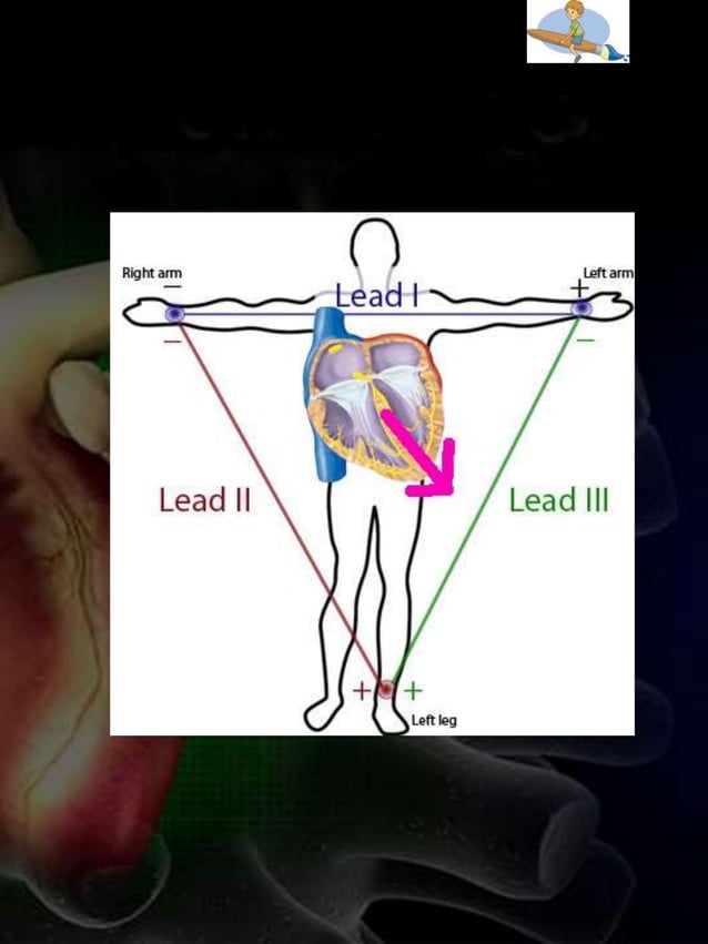 Physiology of ECG ,localisation of MI | PPTX