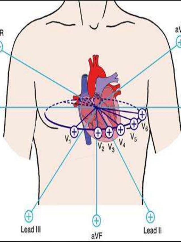 Physiology of ECG ,localisation of MI