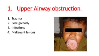 Ashok Kumar Verma (Tracheostomy).pptx.pptx