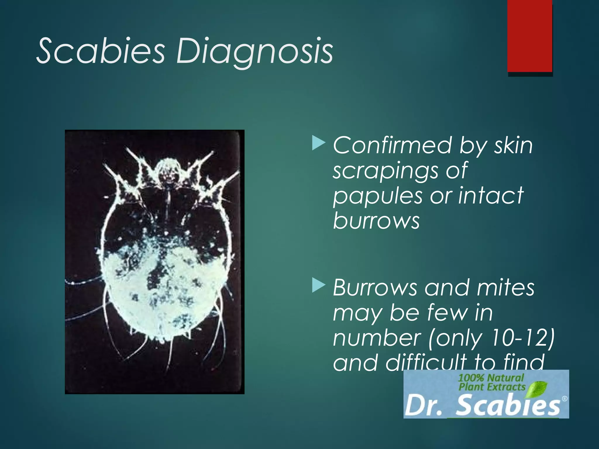 A short guide to scabies treatment 2016 | PPT